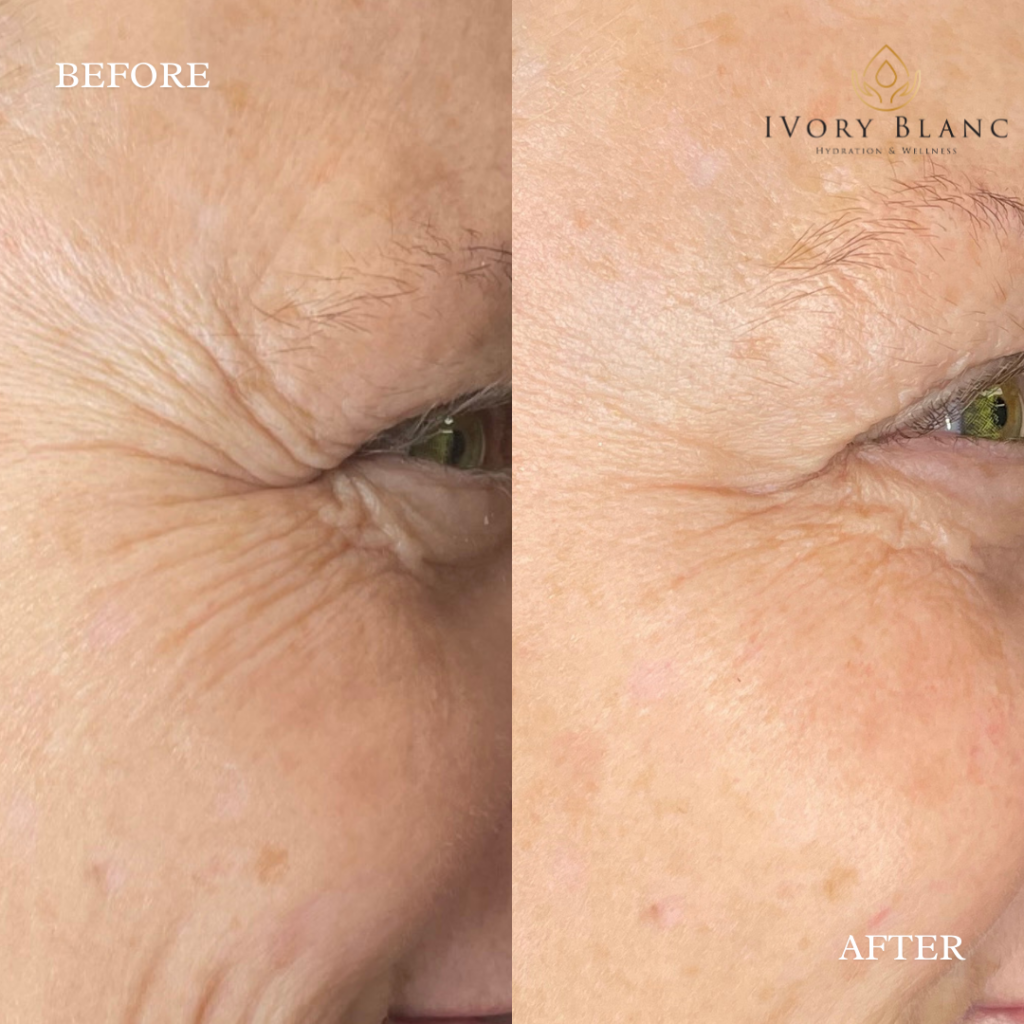 Before & Afters - IVory Blanc Wellness